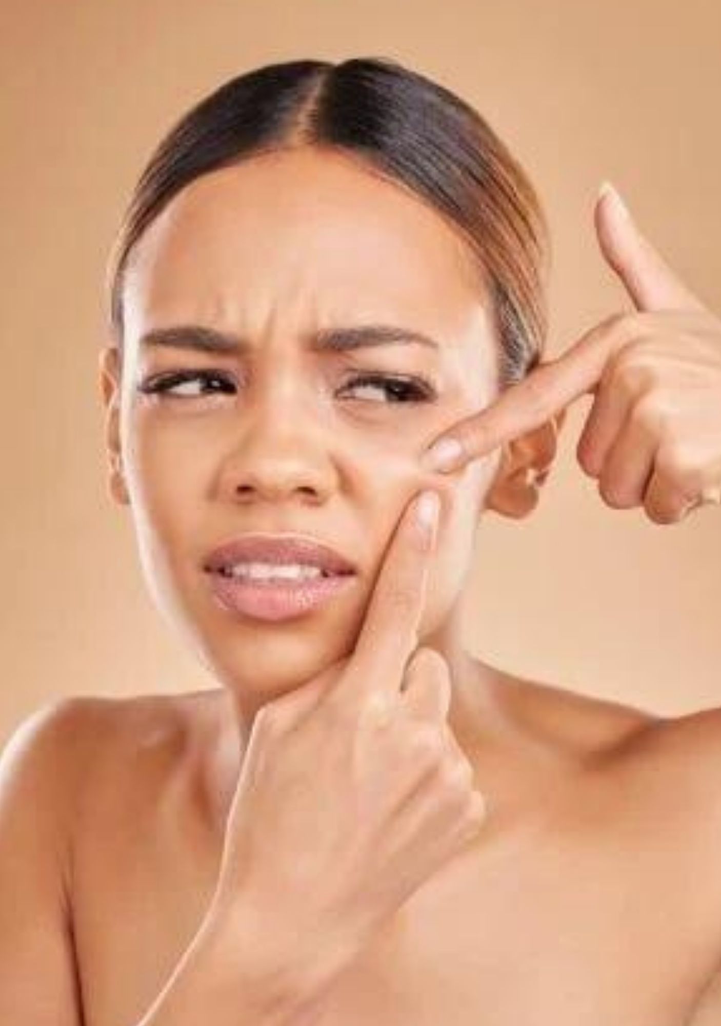 Vücutta Çıkan Sivilceler Nasıl Geçer? Vücutta Çıkan Sivilceler Nasıl Geçer?