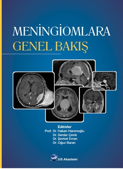 menengiomlara Genel Bakış menengiomlara Genel Bakış